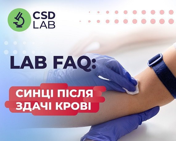 Синець після забору крові: що про це треба знати? | Медична Лабораторія CSD LAB